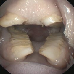 Rabbit and Large Herbivorous Rodent Dental Disease | LafeberVet
