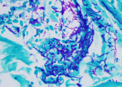 Bearded Dragon Infectious Disease Slideshow - LafeberVet